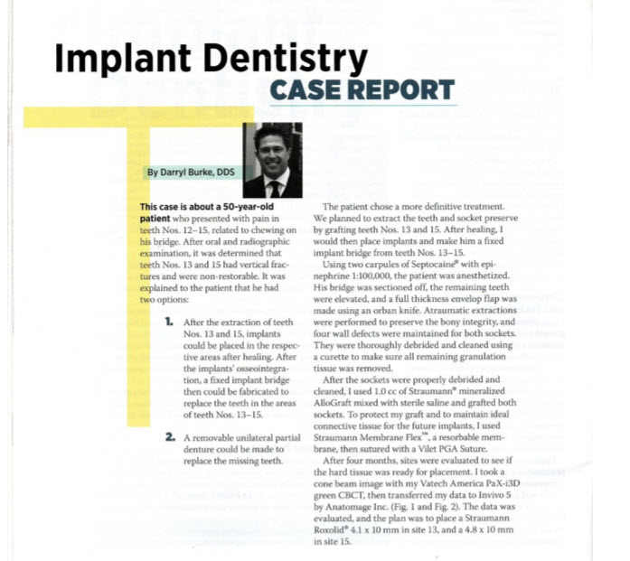 AGD Impact: Implant Dentistry - Implant Dentistry Case Report